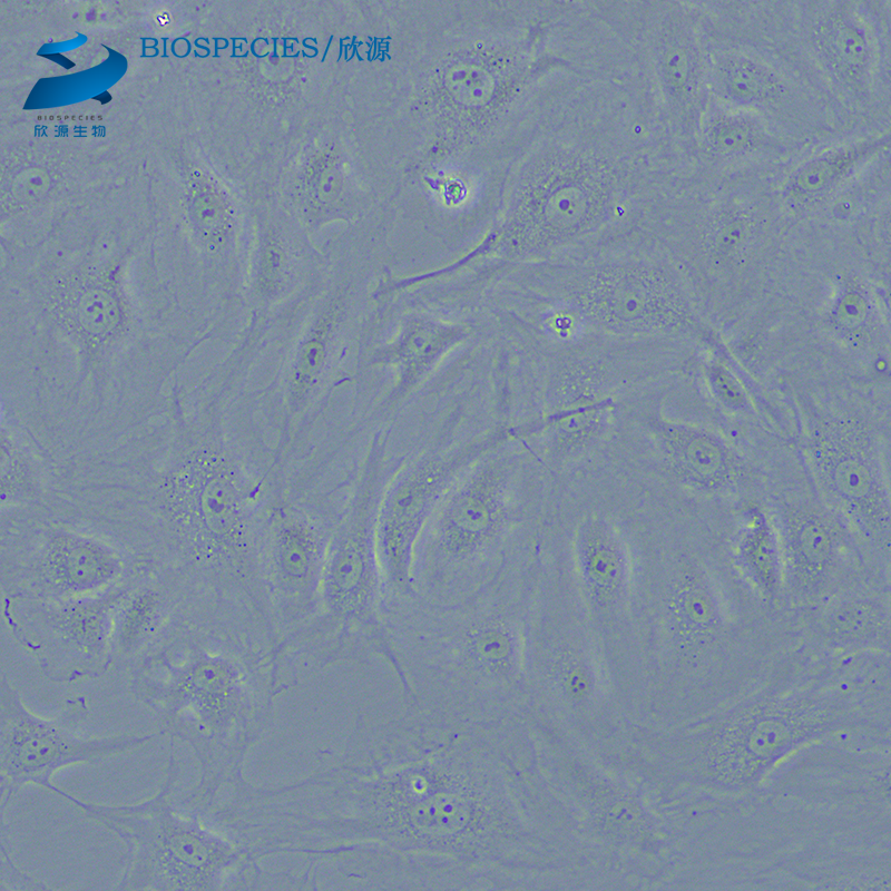 人脐静脉内皮细胞永生化HUVEC+GFP - 广州速研生物科技有限公司