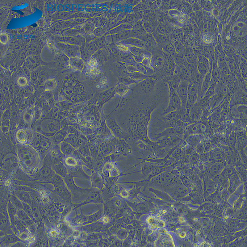 4T1小鼠乳腺癌细胞（新STR鉴定报告）（无支原体无细菌） - 广州速研生物科技有限公司